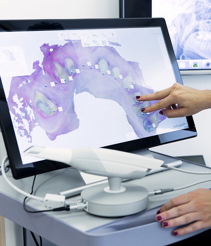 Le scanner intra-oral 3shape TRIOS. - Esthetica Dental Studio